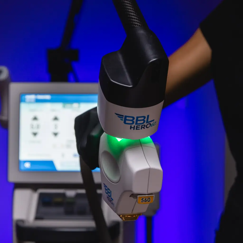 Experience Sciton BBL Hero at Estetica Medspa